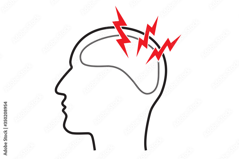 Migraine headache pain and central nervous system disease image concept ...