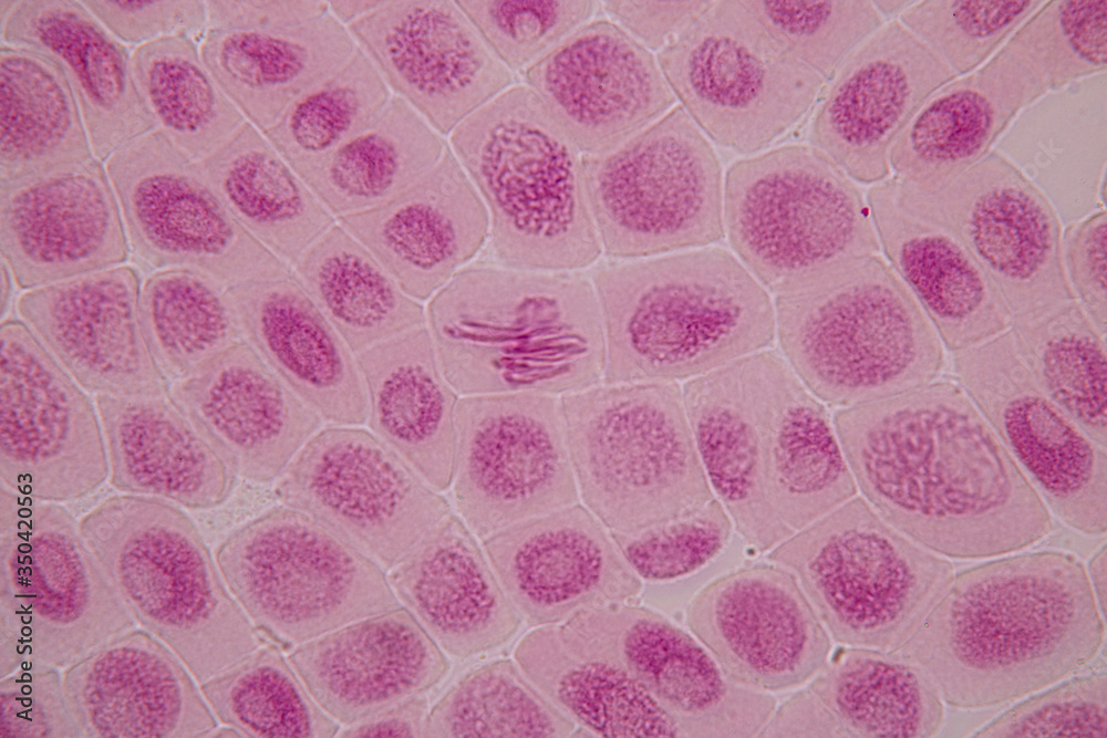 Root tip of Onion and Mitosis cell in the Root tip of Onion under a ...