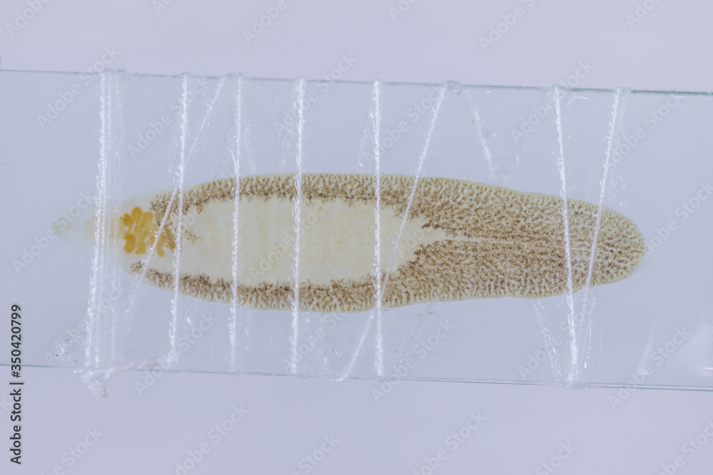 Patterns and backgrounds of Parasitic, Study of Parasitic and ...