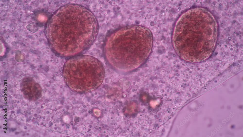 Amoebae move and feed by using pseudopods, which are bulges of ...