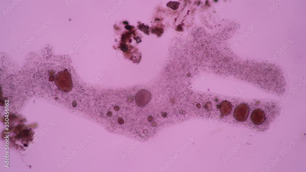 Amoebae move and feed by using pseudopods, which are bulges of ...