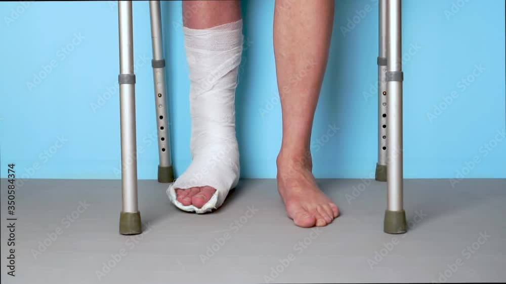 A man with a broken leg in a cast is slowly walking on a walker on a ...