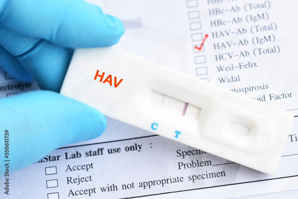 Hepatitis A virus positive test result by using rapid test device Stock ...