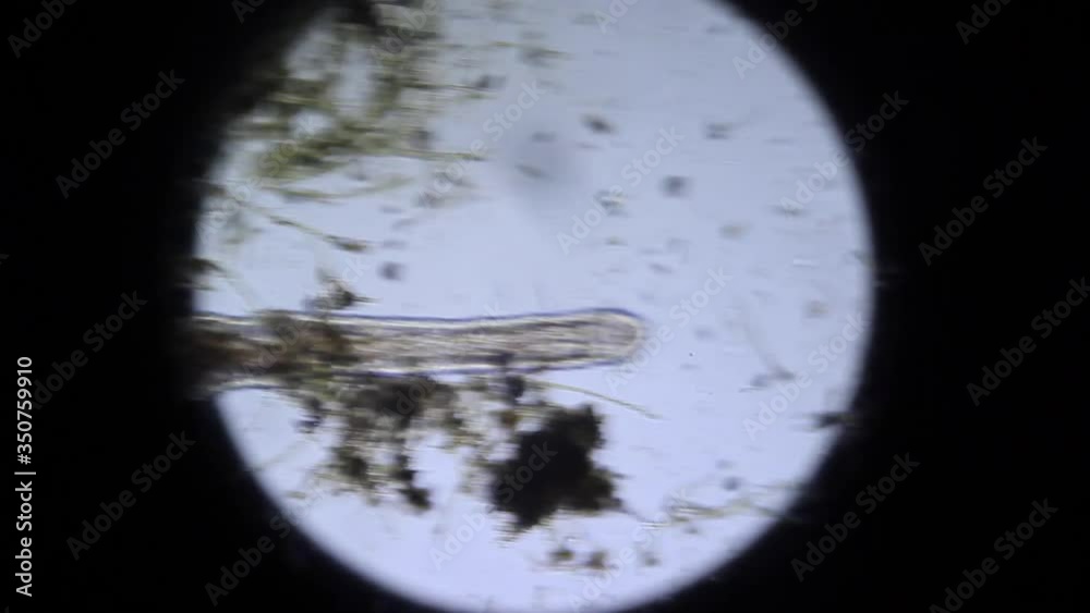 Naididae movement at 100x magnification สต็อกวิดีโอ | Adobe Stock