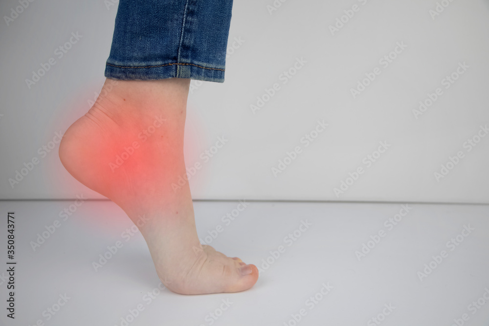 Woman suffering from heel pain. Inflammation or sprain of the tendon in ...