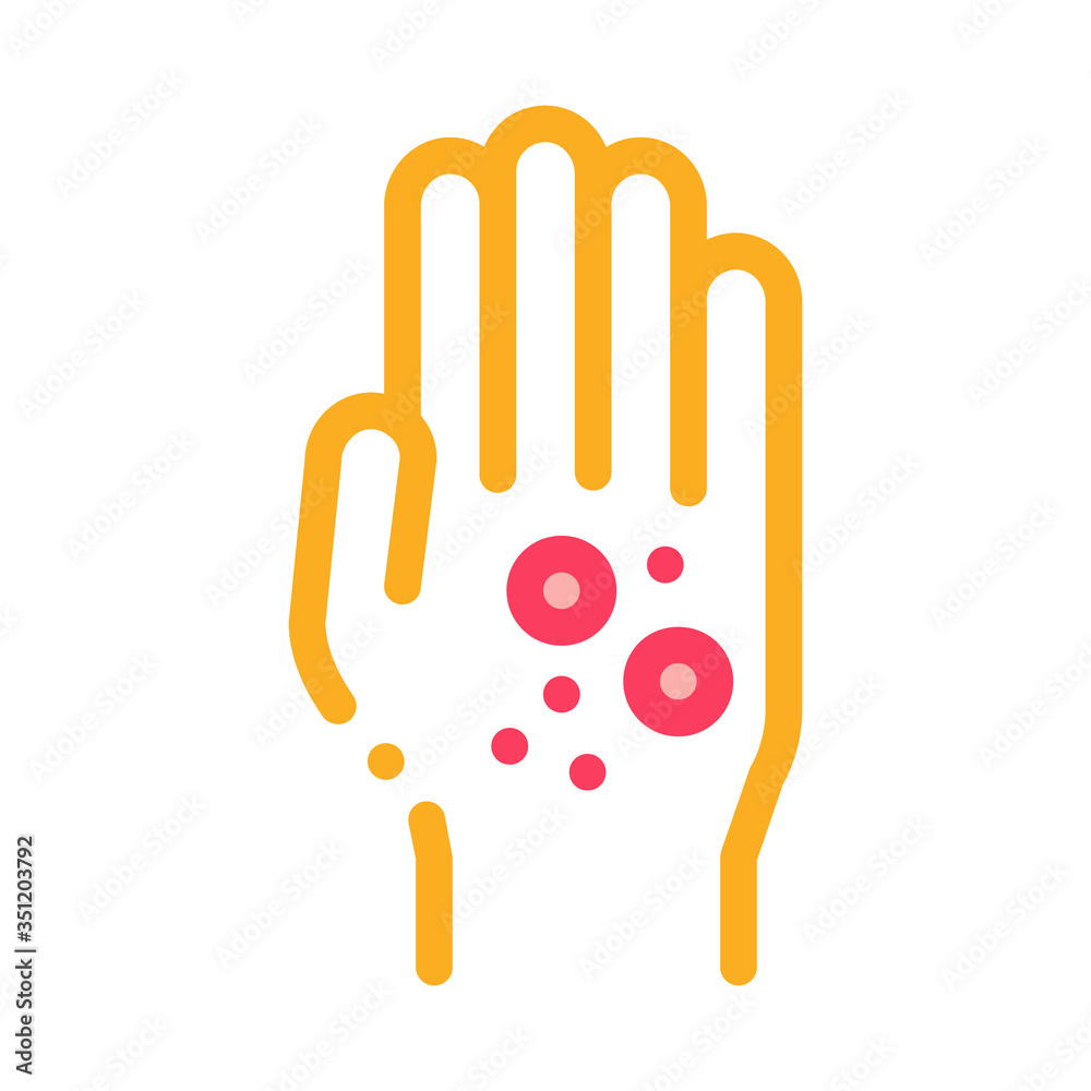 dermatitis rash on hands icon vector. dermatitis rash on hands sign ...