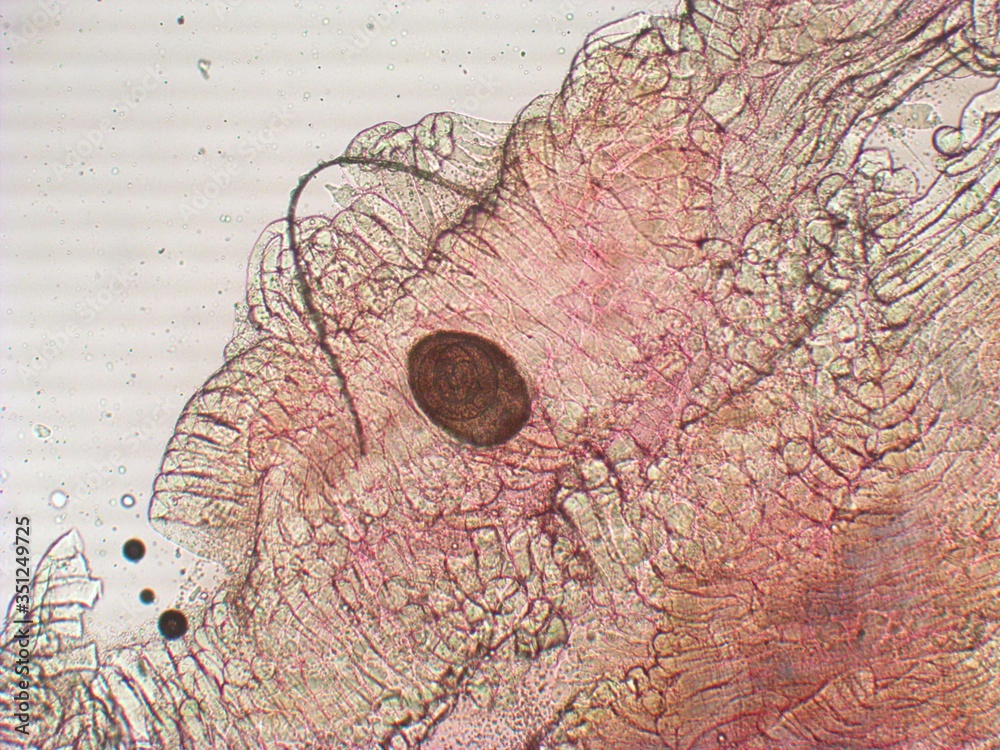 Trichinella spiralis - parasitic worm microscope Stock Photo | Adobe Stock
