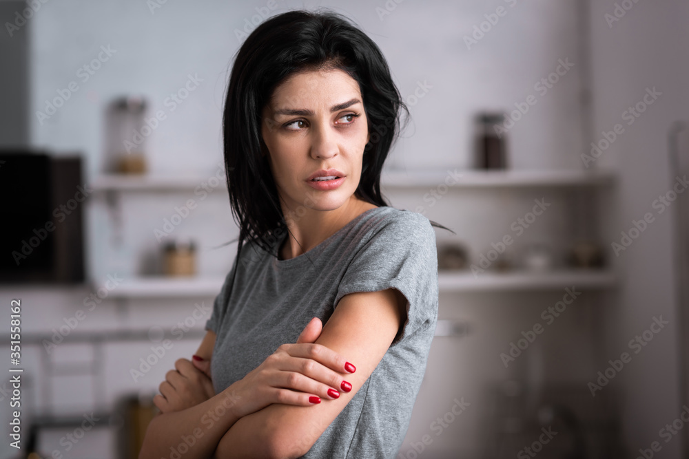 sad woman touching bruise on hand and looking away, domestic violence ...