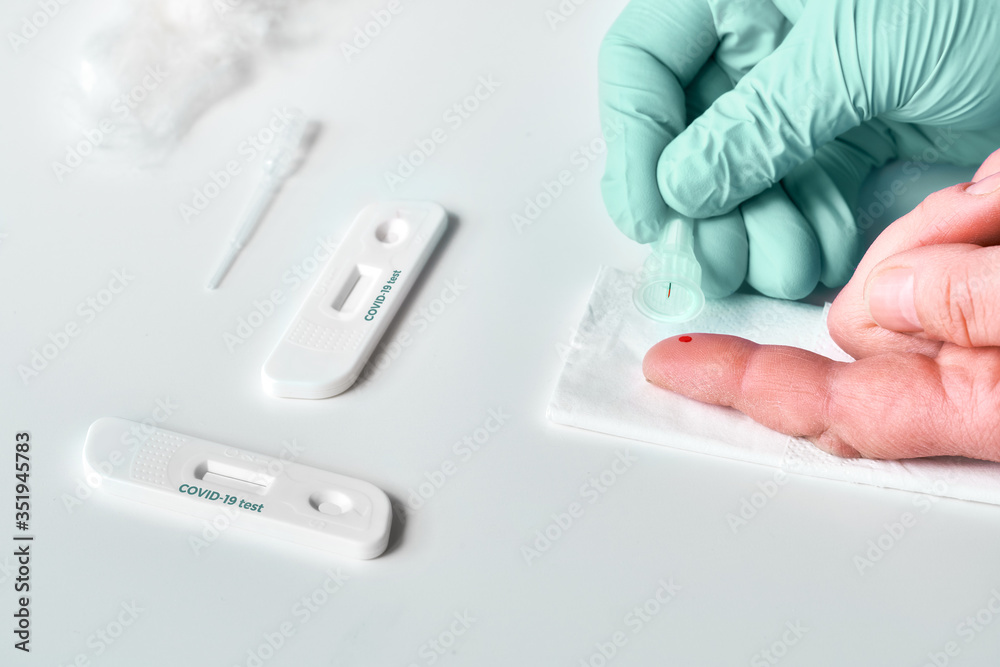 Rapid COVID-19 test for detection of specific antibodies IgM and IgG to ...