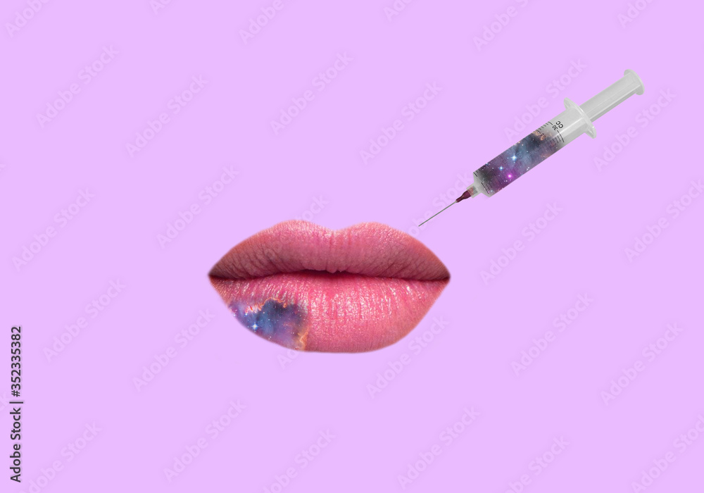Injection on the lips. Silicone in the lips. Hyaluronic acid in a ...