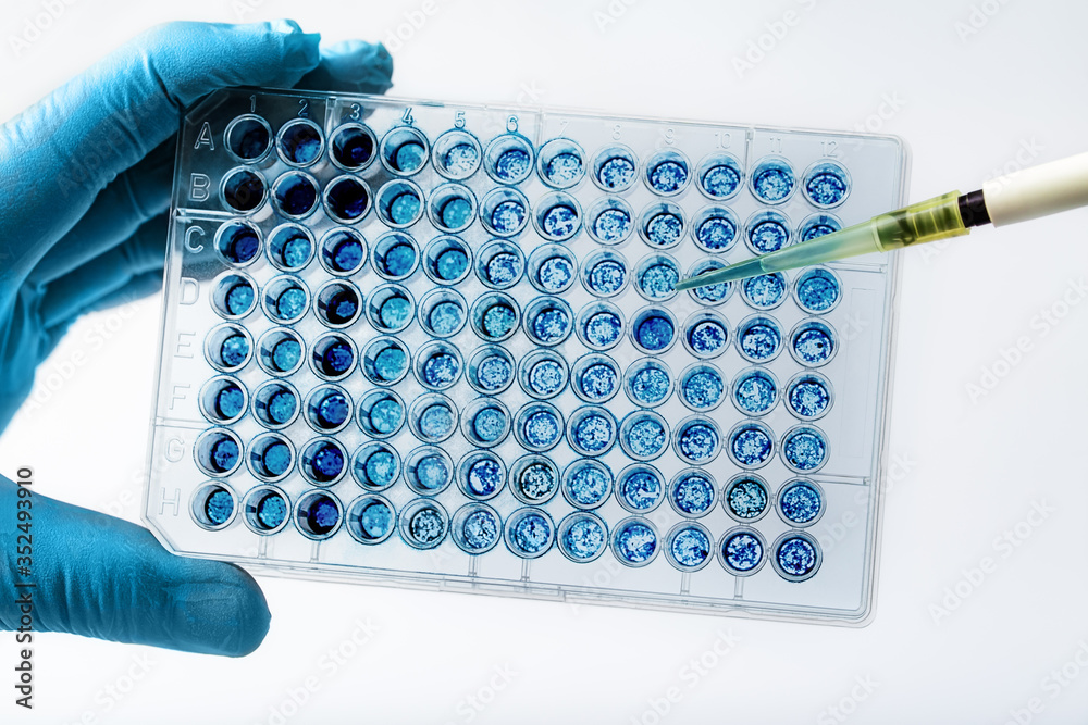Biologist in lab holding a 96 well multi plate with biological samples ...