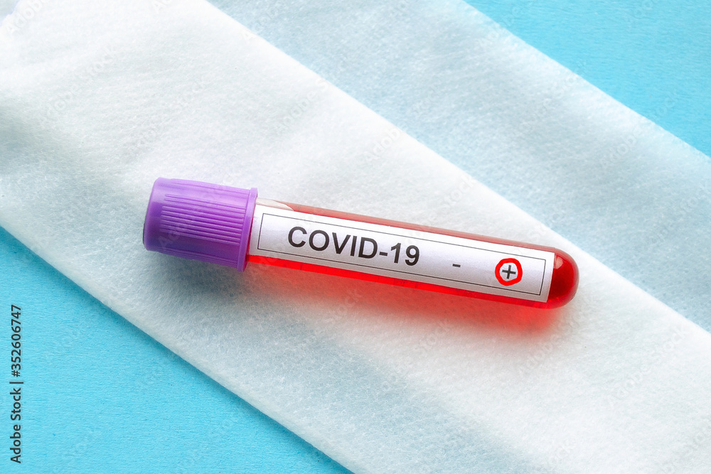 Positive test result COVID-19, top view. Test tube with a positive ...