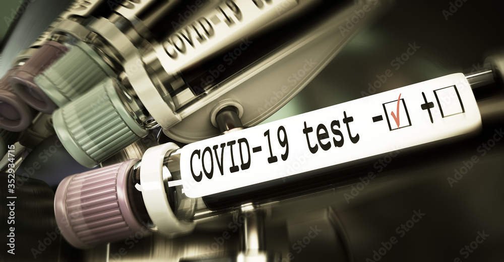 Vials of blood in a centrifuge. Negative COVID-19 test and laboratory ...