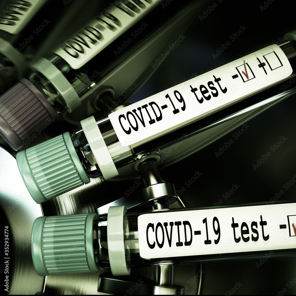 Tube of biological sample contaminated by Coronavirus with label Covid ...