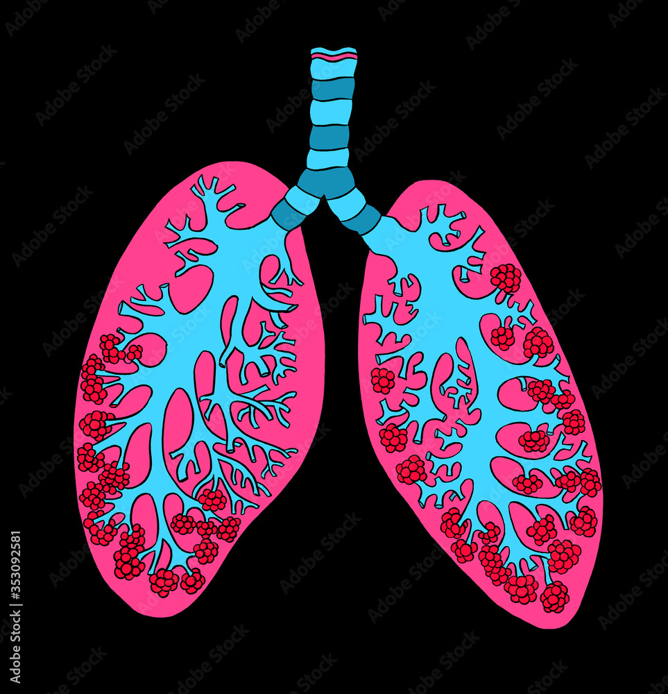 Lungs Stock Illustration | Adobe Stock Lungs Stock Illustration | Adobe Stock