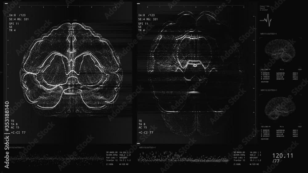 Brain scan visualization footage. The device scans and displays vital ...