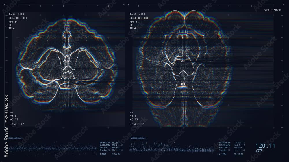 Brain scan screen animation. The device scans and displays vital signs ...