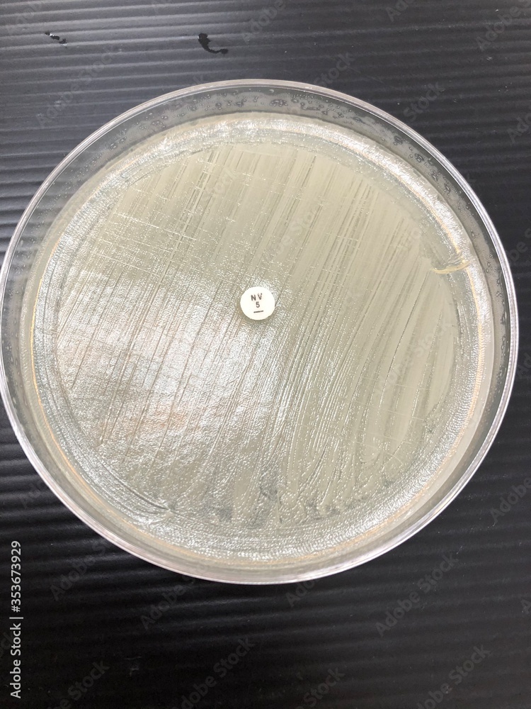NOVOBIOCIN TEST : Staphylococcus saprophyticus on Mueller hinton agar ...