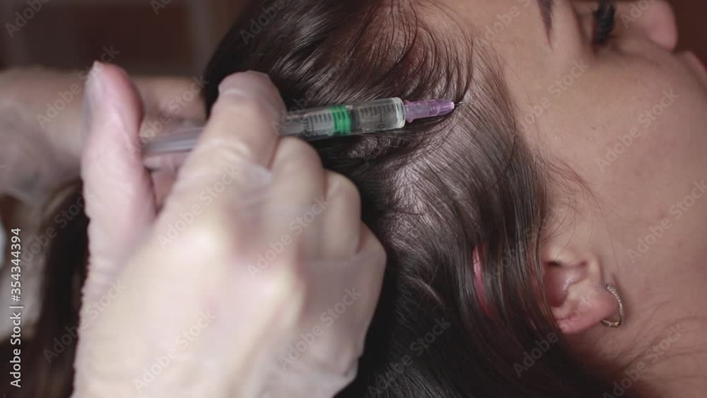 The doctor makes injections into the scalp for hair growth. Mesotherapy ...