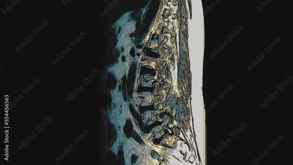 Video „Bulk multicolored MRI of the female pelvic organs, abdominal ...