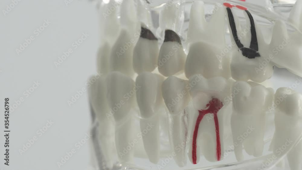 The layout of the human jaw on a white background with bad teeth. The ...