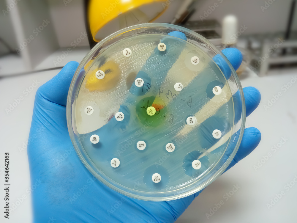 Scientist hold a Culture plate of bacterial growth showing antibiotic ...