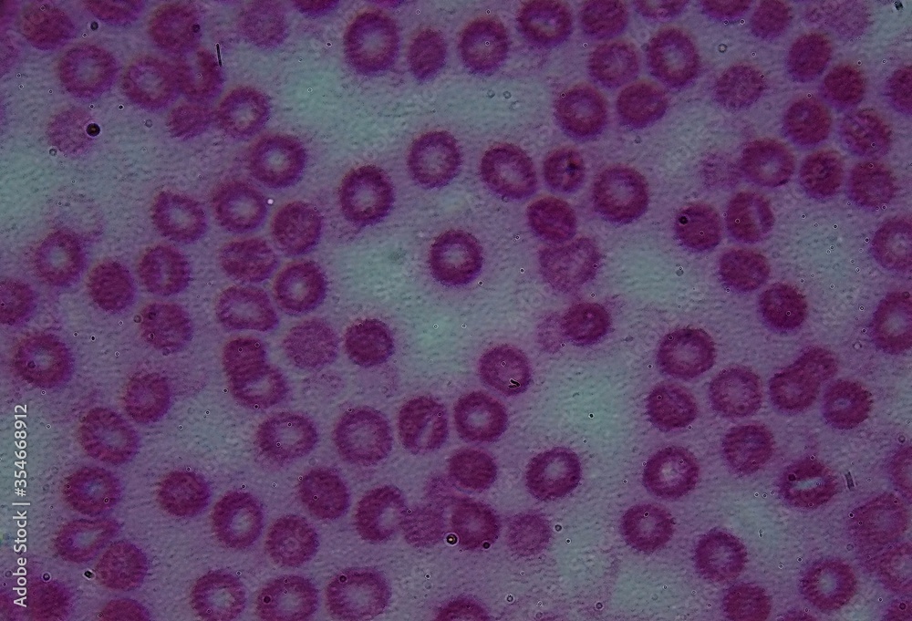 Human blood smear under microscope hemoglobin Stock Photo | Adobe Stock
