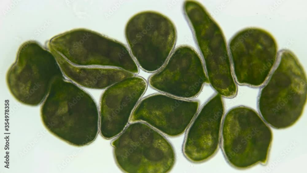 Flatworm Typhloplana sp. under a microscope, the Typhloplanidae family ...