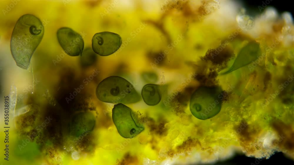 colony Infusoria Stentor under the microscope, the family Stentoridae ...