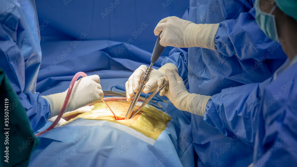 Close up photo of doctor perform surgery inside modern operating room ...