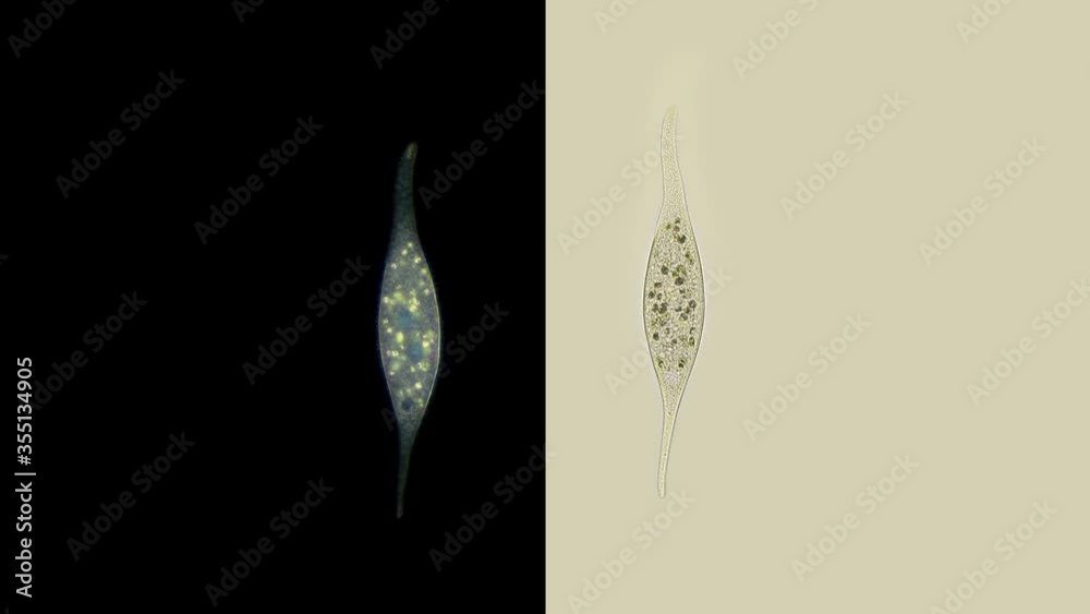 Amphileptus ciliates under a microscope, Amphileptidae family, class ...