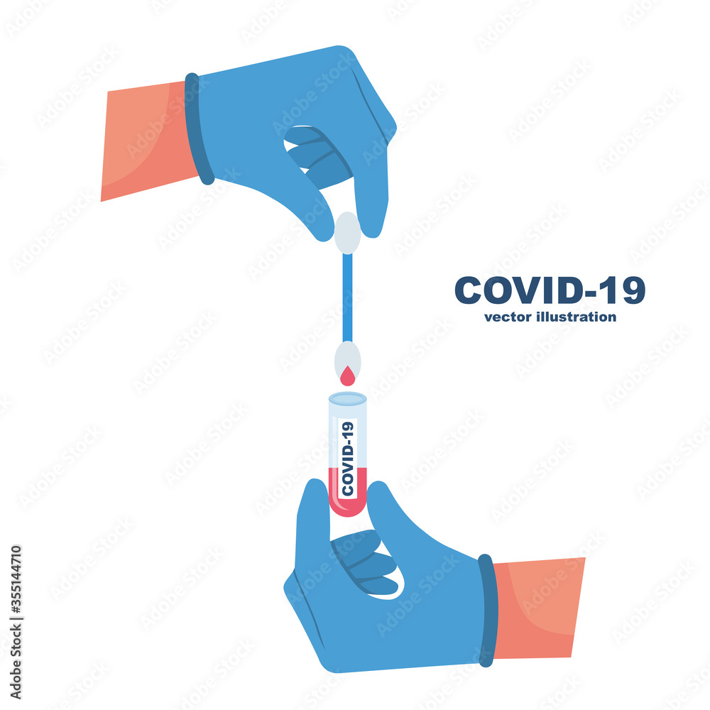 COVID-19 laboratory test in hospital lab. Doctor holds in hands smear ...