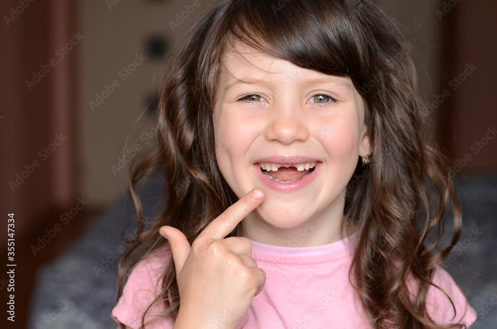 Cute Preschooler Showing Her Milk Teeth Fell Out And Her Growing