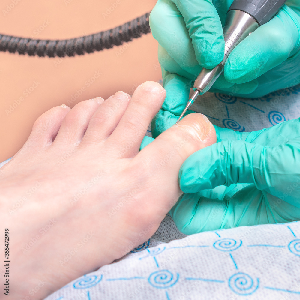 Professional hardware pedicure using electric machine.Patient on ...