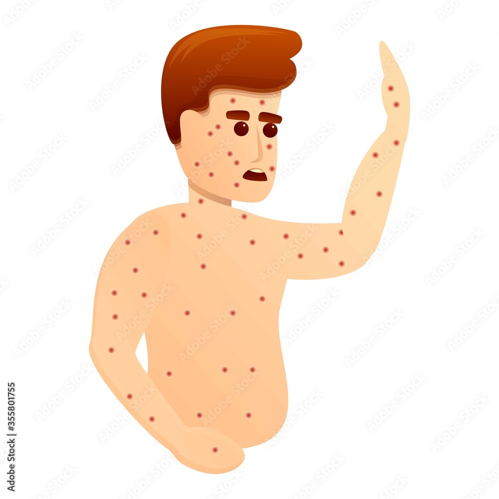 Chicken pox body icon. Cartoon of chicken pox body vector icon for web ...