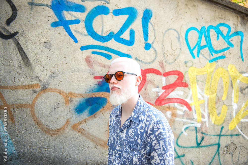 Albinism is beautiful. Stock Photo | Adobe Stock