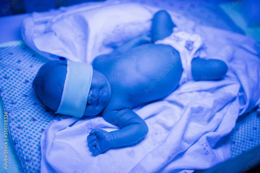 Newborn having a treatment for jaundice under ultraviolet light, Baby ...
