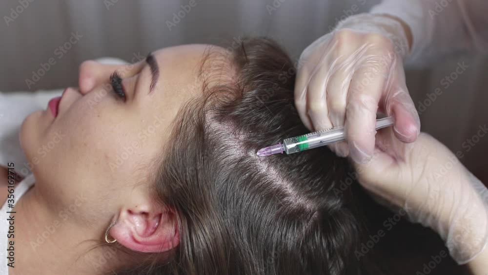 The doctor makes injections into the scalp for hair growth. Mesotherapy ...