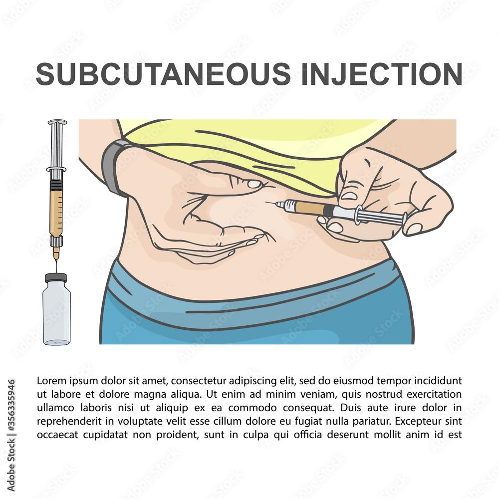SUBCUTANEOUS INJECTION In Stomach Medical Human Illness Vector ...