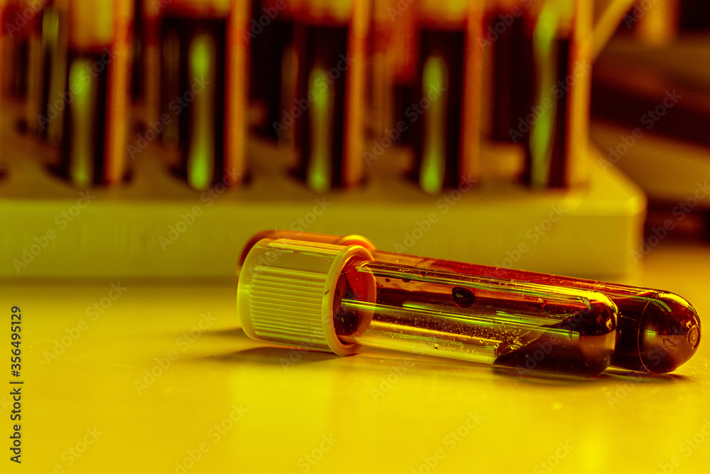 Tubes with blood samples on laboratory desk Stock Photo | Adobe Stock