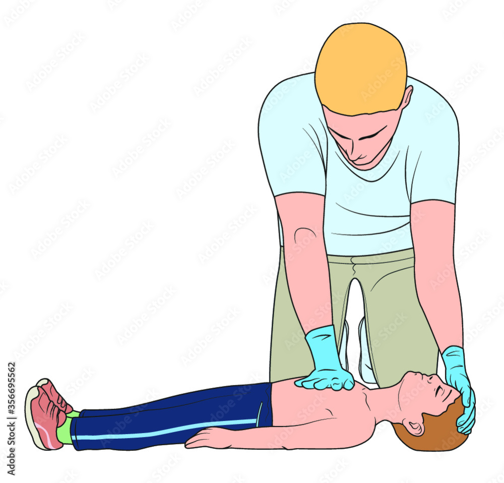 RCP Reanimación cardiopulmonar en niños - Primeros auxilios เวกเตอร์สต็อก | Adobe Stock