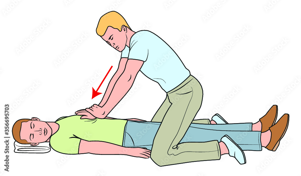 Maniobra de Heimlich en suelo - Primeros auxilios vector de Stock ... Maniobra de Heimlich en suelo - Primeros auxilios vector de Stock ...