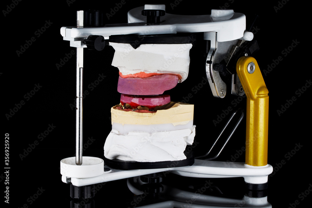 dental articulator with plaster models, bite roller and support pin for ...