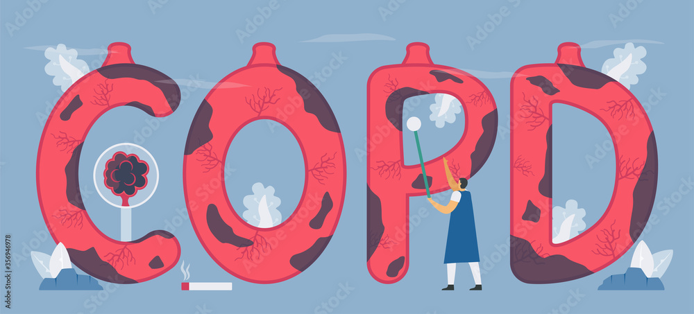 Poster Chronic obstructive pulmonary disease or COPD – Wall Art | UkPosters