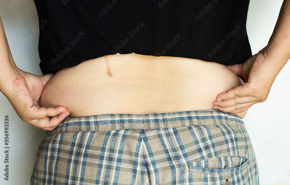 Individual postures show the back muscles that have subcutaneous fat ...