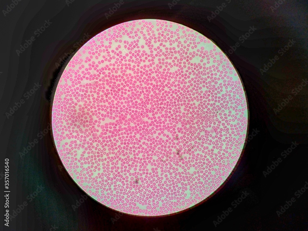 The red blood cell of the human was dyed by Wright's stain. The red ...