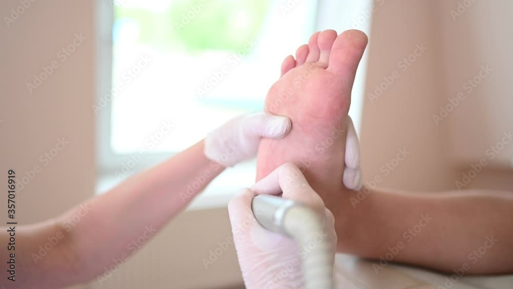 Podiatrist doctor using grinding equipment and making procedure polish ...