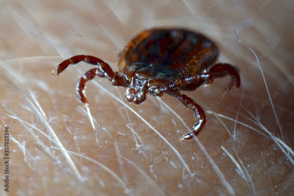 Macro close up of crawling parasitic Dermacentor reticulatus crawling ...