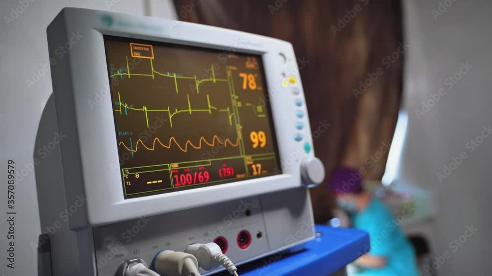 Heart rate monitor in surgical room. Vital signs of a patient on the ...