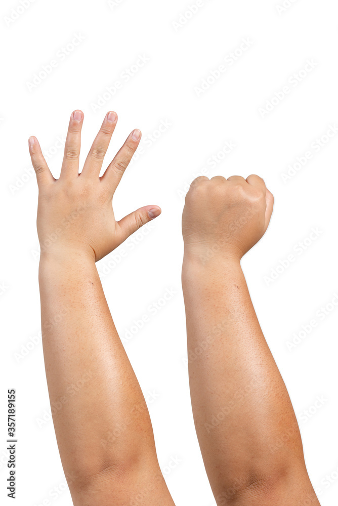 arm of a fat man with brown skin is lifting Stock Photo | Adobe Stock